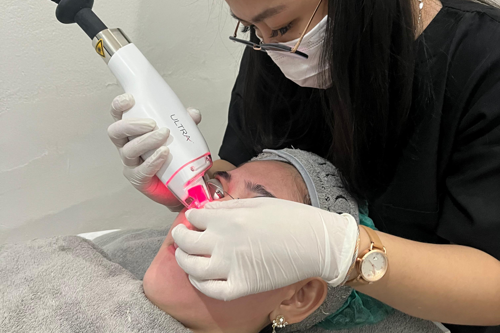 Yugen ULTRA Laser – Yugen Clinic